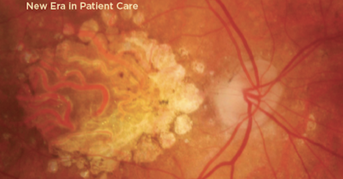 Lad Featured in Cover Article for AAO EyeNet | Duke Department Of ...