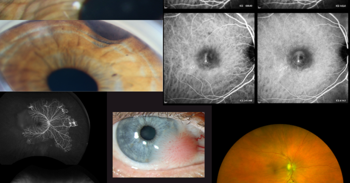 Duke Ophthalmic Photographers Earn Top Awards | Duke Department Of ...