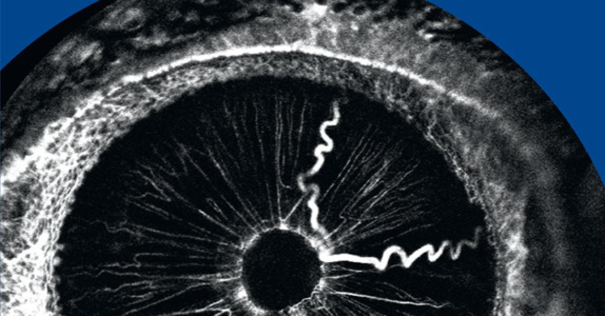 Duke Ophthalmic Photographer's Photo Featured on Cover of AAO Journal ...